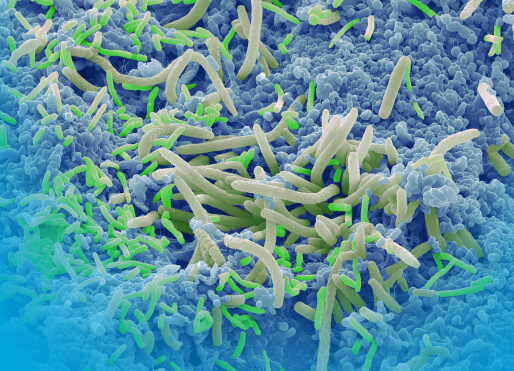 Normaflore gyógyszerek a bélflóra egyensúlyáért